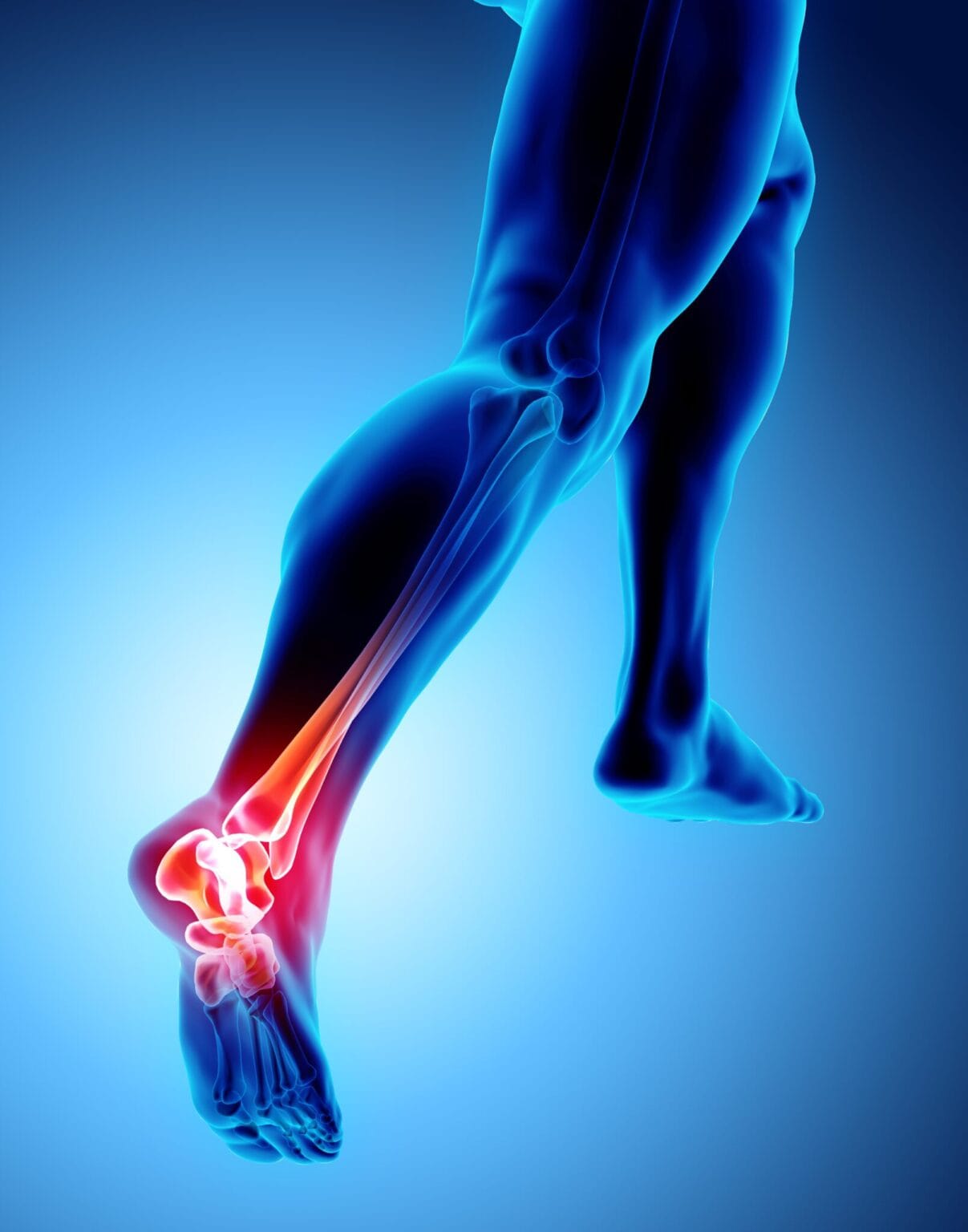 Peroneus overbelasting (pijn buitenkant van enkel/voet) - Running Solutions