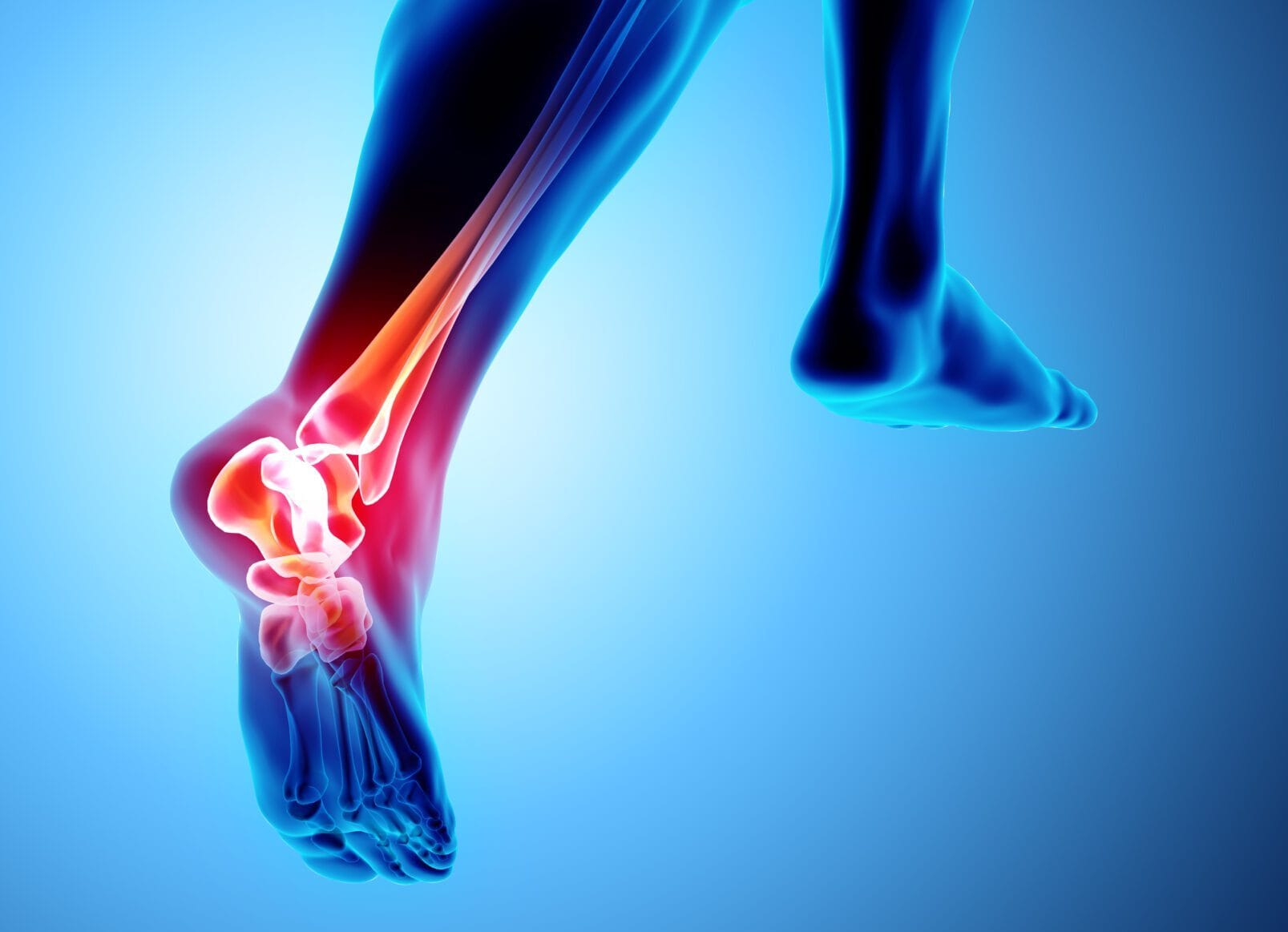 Peroneus overbelasting (pijn buitenkant van enkel/voet) - Running Solutions