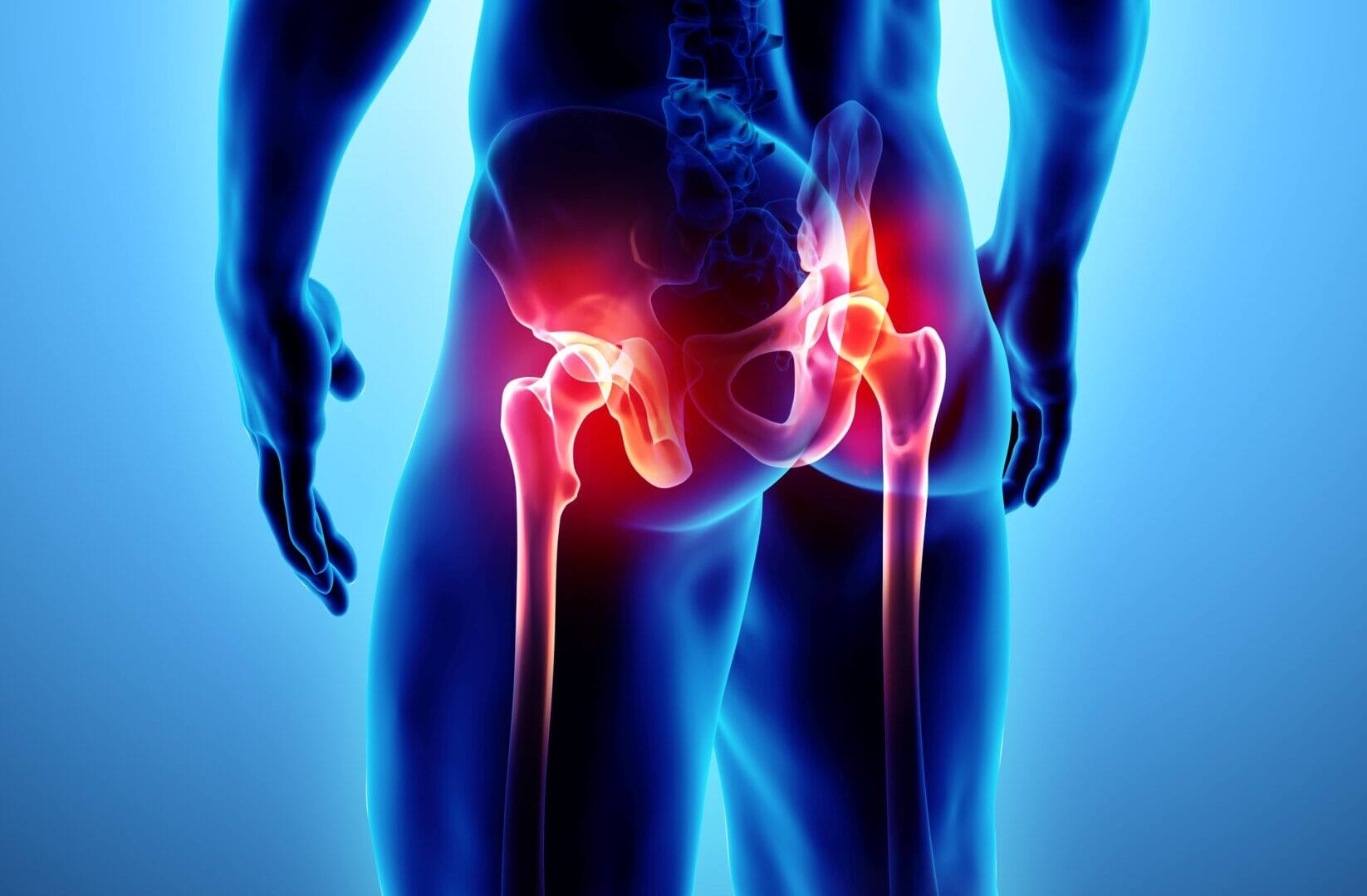 Labrum scheur in de heup - Running Solutions