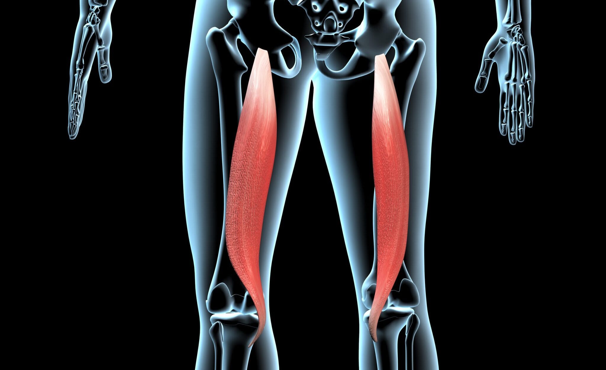 Hamstring Tendinopathie (hamstring pijn rond zitbot) - Running Solutions